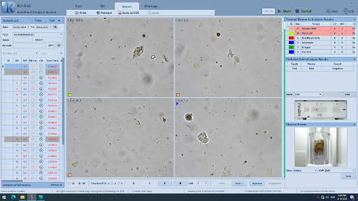 Parasitology Diagnostics | KEYU Fully Automated Feces Analyzer